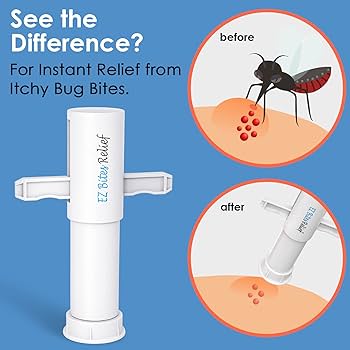 Experience Instant Relief -Ultimate Bite & Sting Relief Tool - For Itc ...